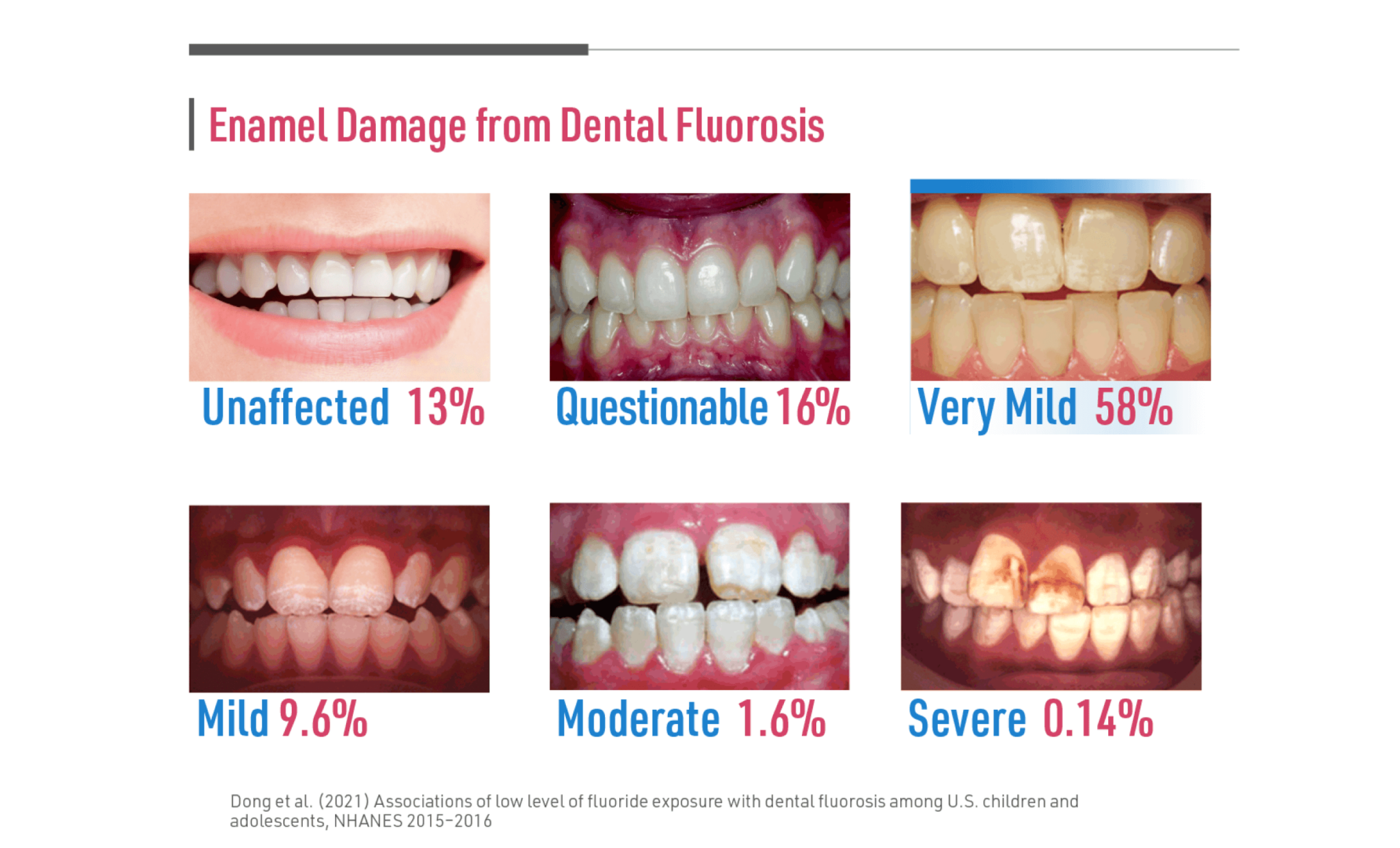 Dental - Fluoride Action Network